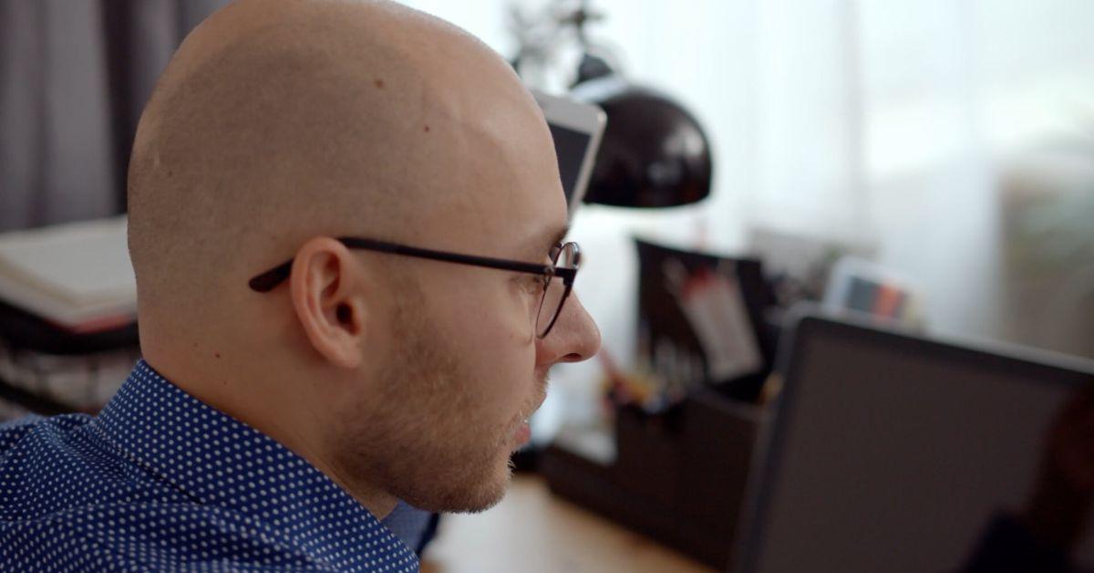 Alopecia, in Italia colpisce 4 uomini su 10. Il trapianto una soluzione - Il Giornale d'Italia