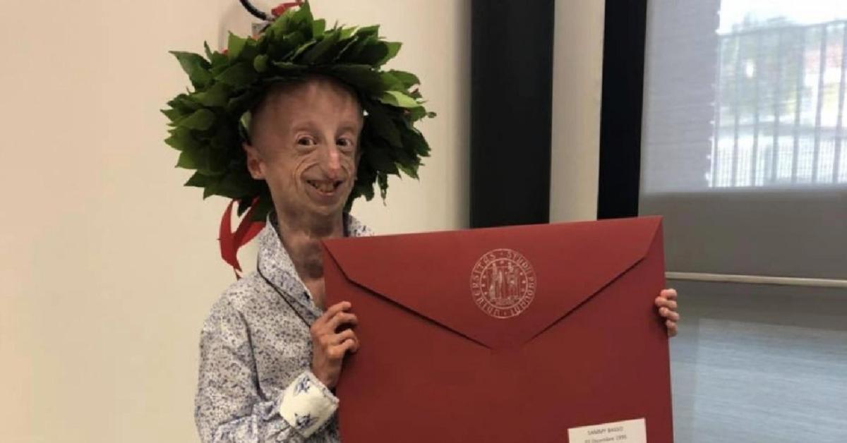 Sammy Basso: fidanzata, quanto può vivere, malattia, laurea, genitori ...