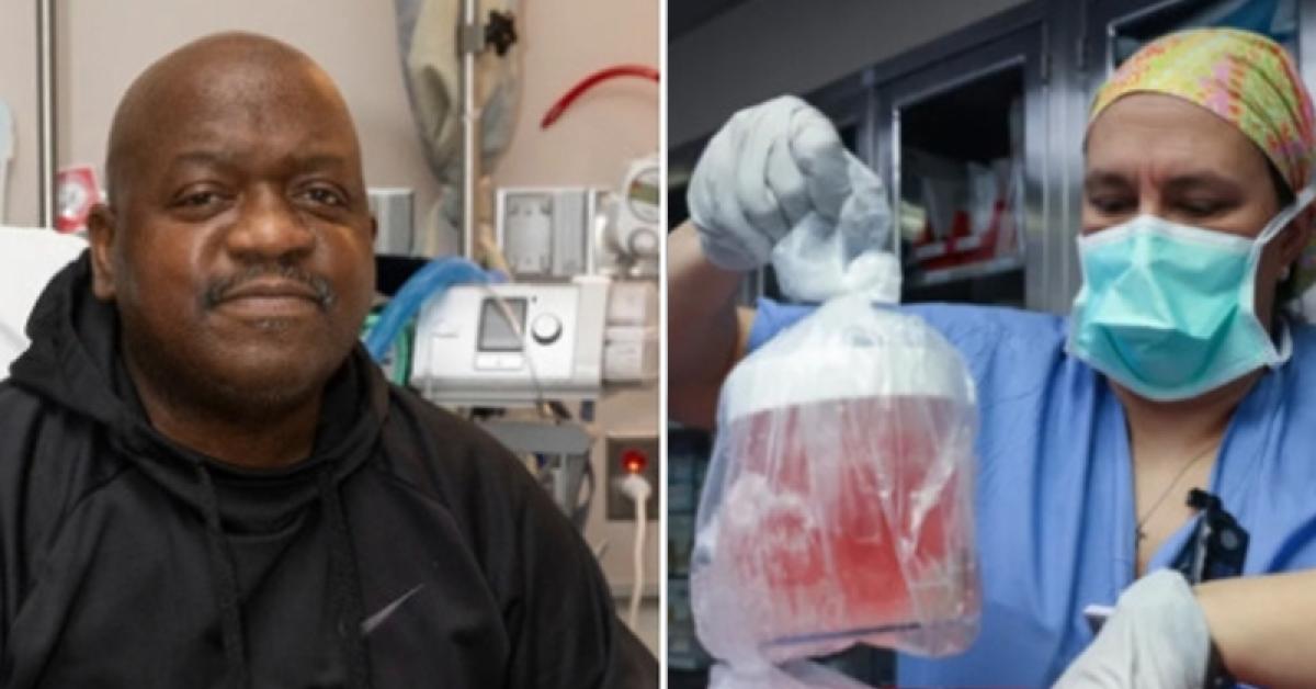 Richard Slayman, morto l'uomo con un rene di maiale 2 mesi dopo il ...