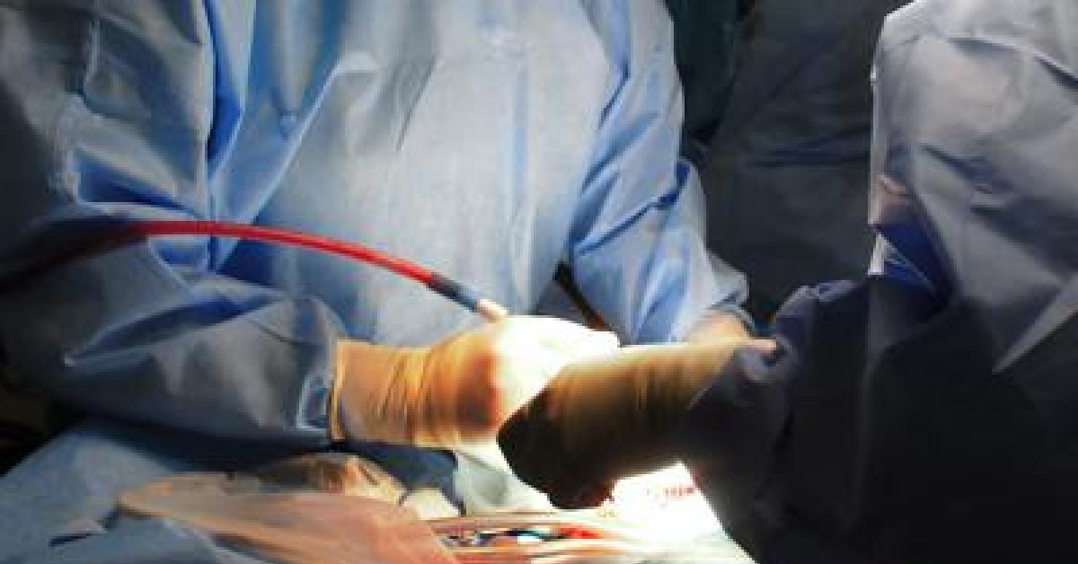 Laparocele, uno degli inconvenienti della chirurgia addominale - Il ...